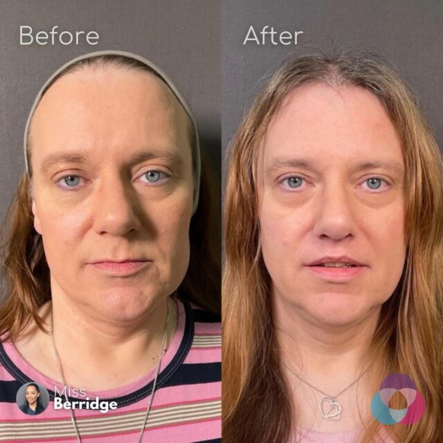 Male To Female Transgender Before And After